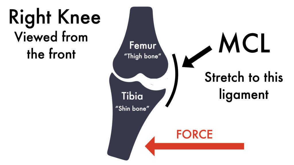 De-mystifying the ligaments of the knee (ACL, MCL, PCL, LCL ...